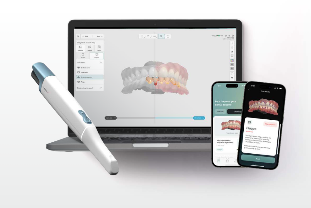 TRIOS 6 : le nouveau scanner intra-oral 3Shape